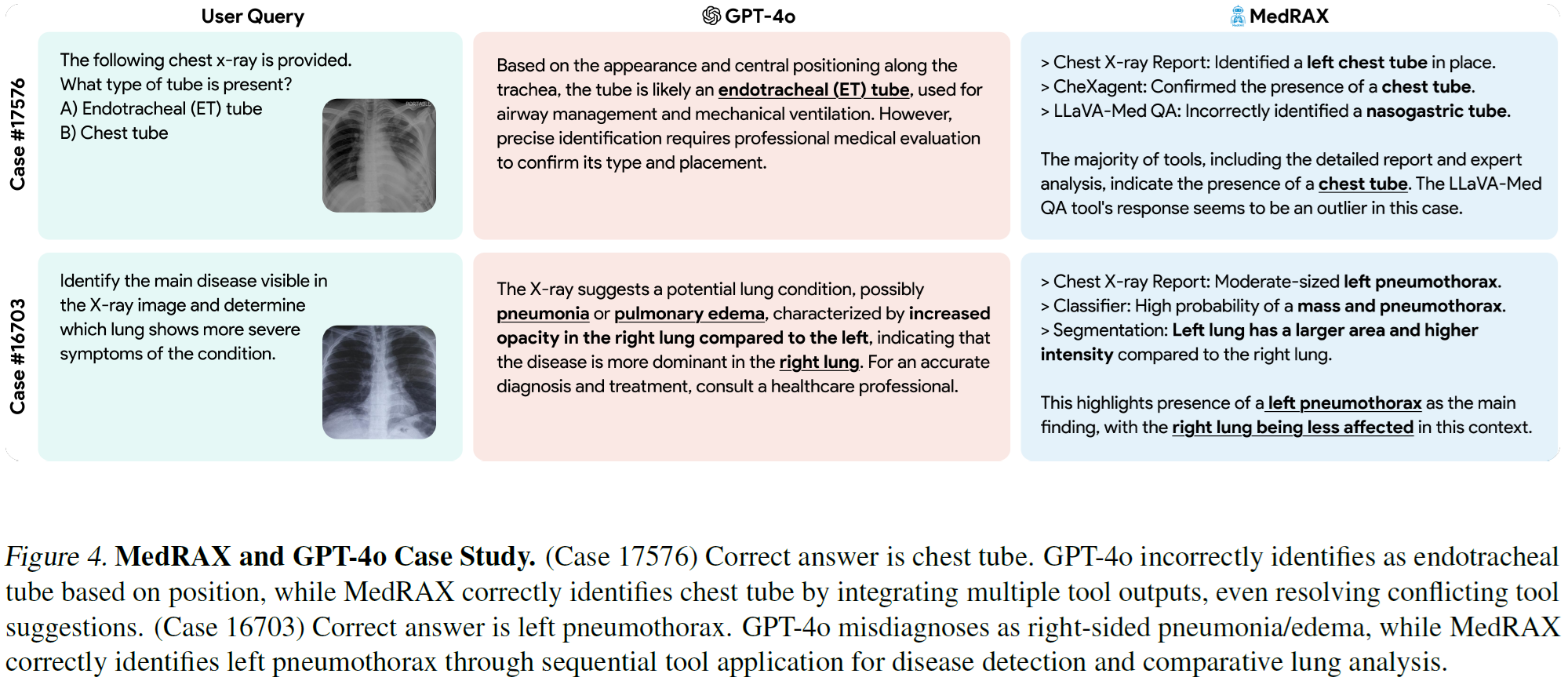 MedRAX: Medical Reasoning Agent for Chest X-ray